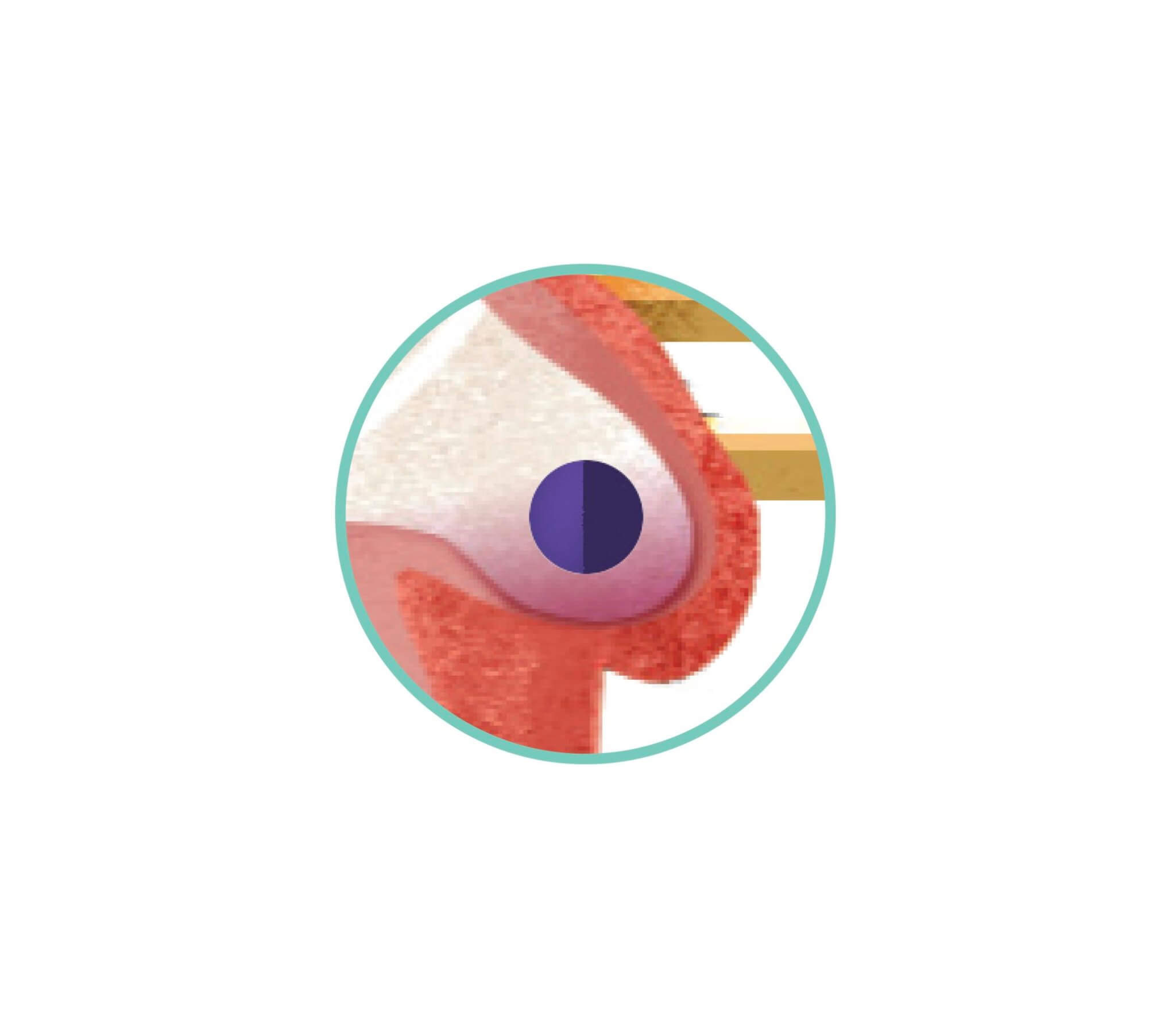 WATCHMAN FLX Pro AFib Implant - Cardiac Care | Singing River Health System