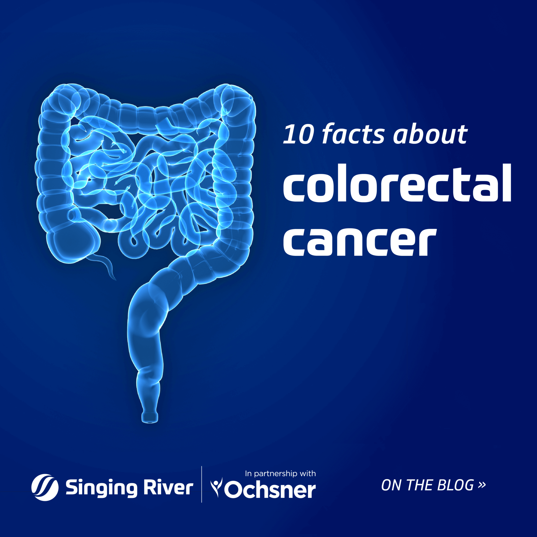 10 Facts About Colorectal Cancer - Singing River Health System