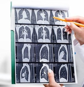 Radiology for Dummies | Singing River Health System