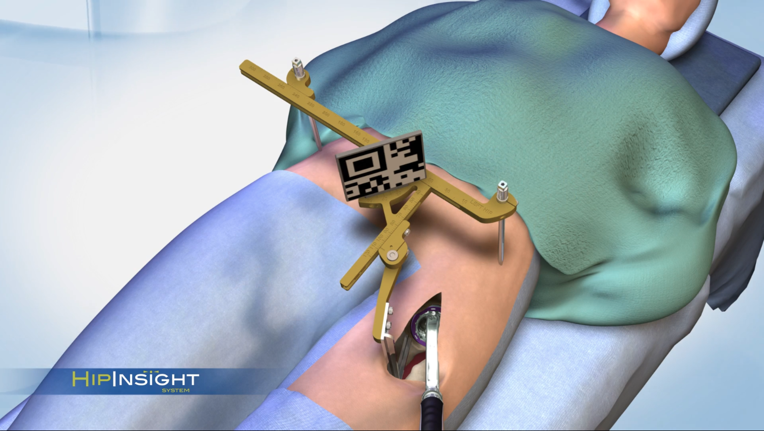 Singing River Orthopedic Surgeon is First in Mississippi to Perform ...