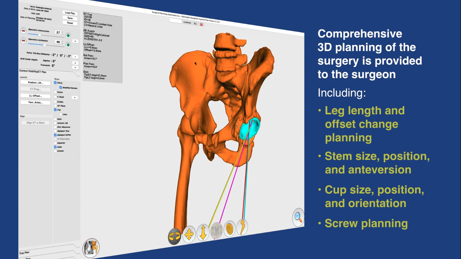 Singing River Orthopedic Surgeon is First in Mississippi to Perform ...
